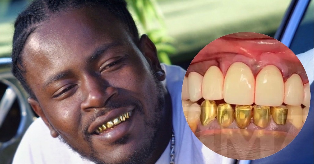 Trick Daddy's Iconic Gold Grills Replaced After 30 Years - $60K Smile ...