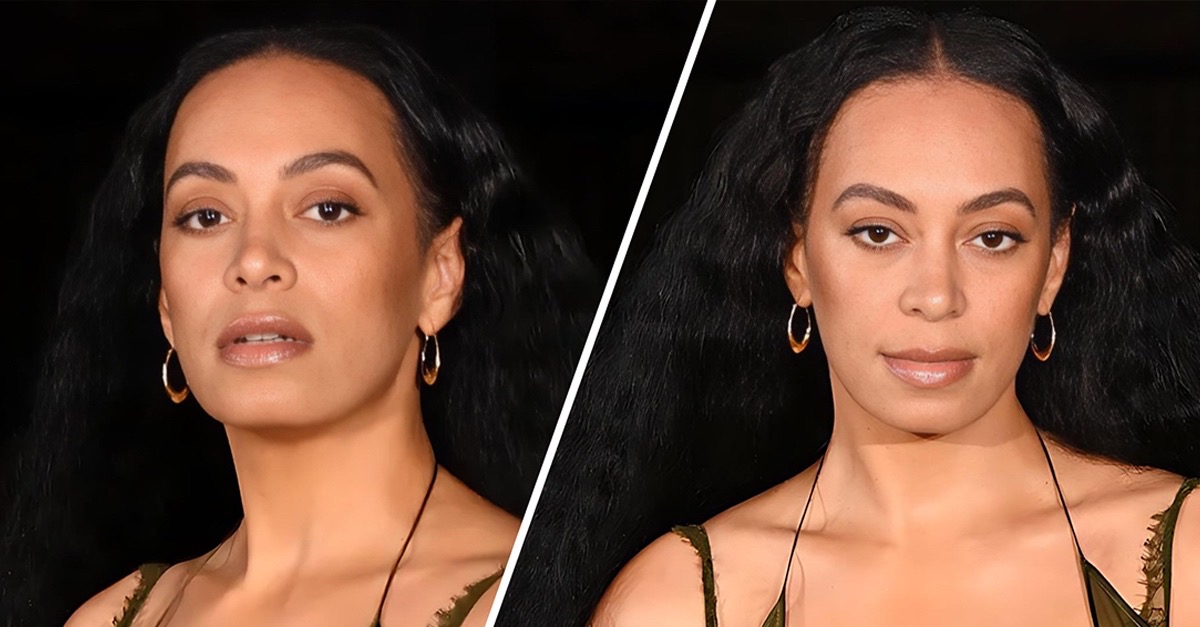 Solange Opens Up About Health Battle with Autoimmune Disorders ...